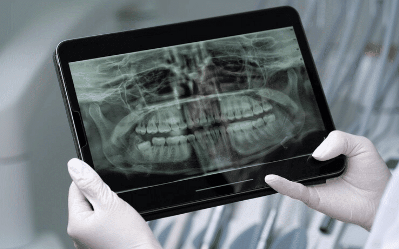 Dental Radiographs Oak Forest - Advanced Solutions Family Dental