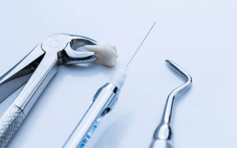 How Painful Is Tooth Extraction Without Anesthesia?